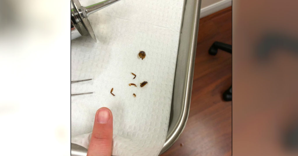 Cockroach Crawls In Sleeping Woman's Ear, Takes 9 Days & 3 Dr. Visits ...